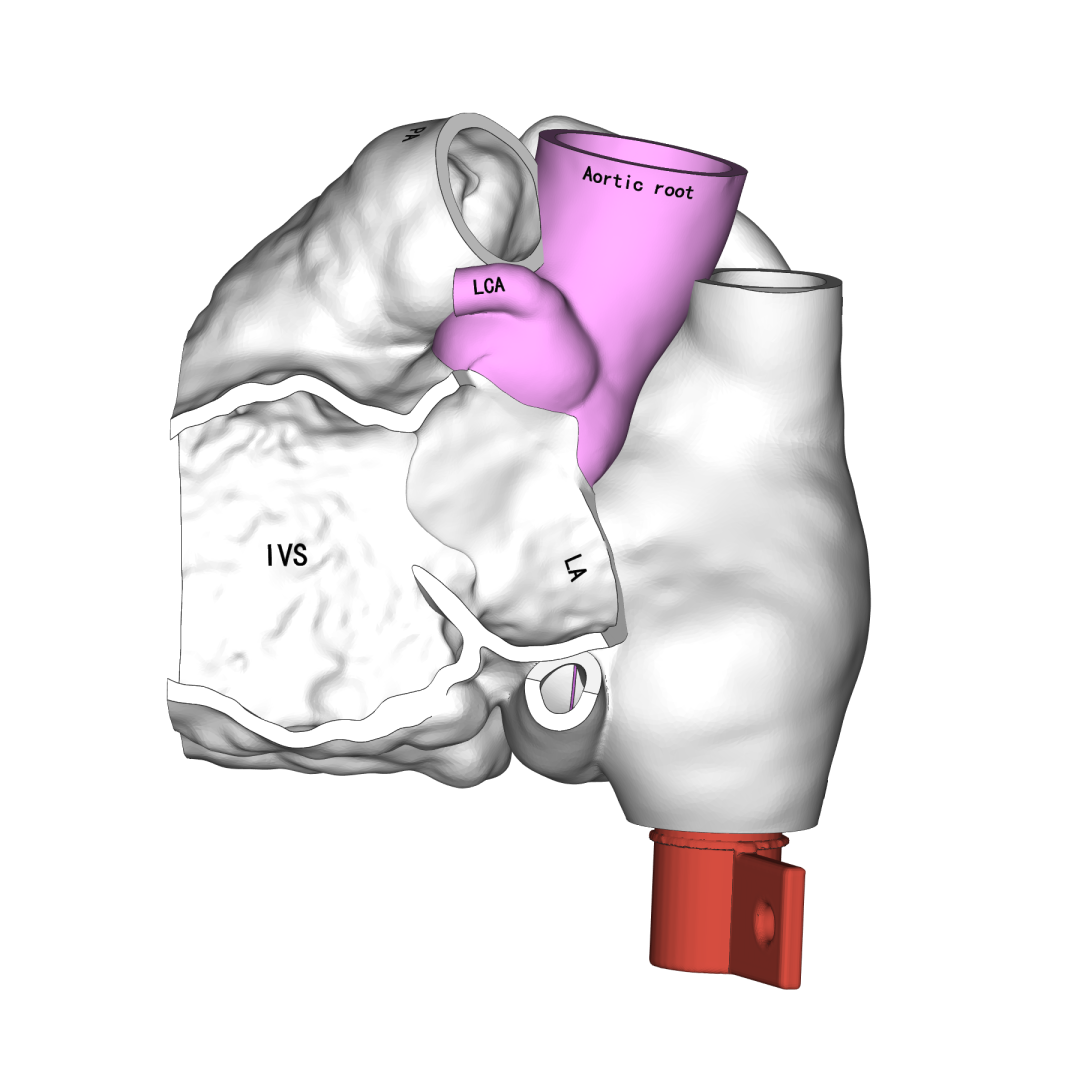 马克医疗助力LuX-Valve系列产品亮相TVT2022获高度认可 - 马克医疗